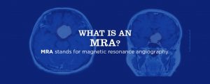 MRI vs MRA | What's the Difference