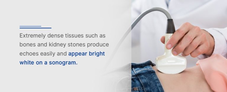 Ultrasound vs. Sonogram | What's the Difference