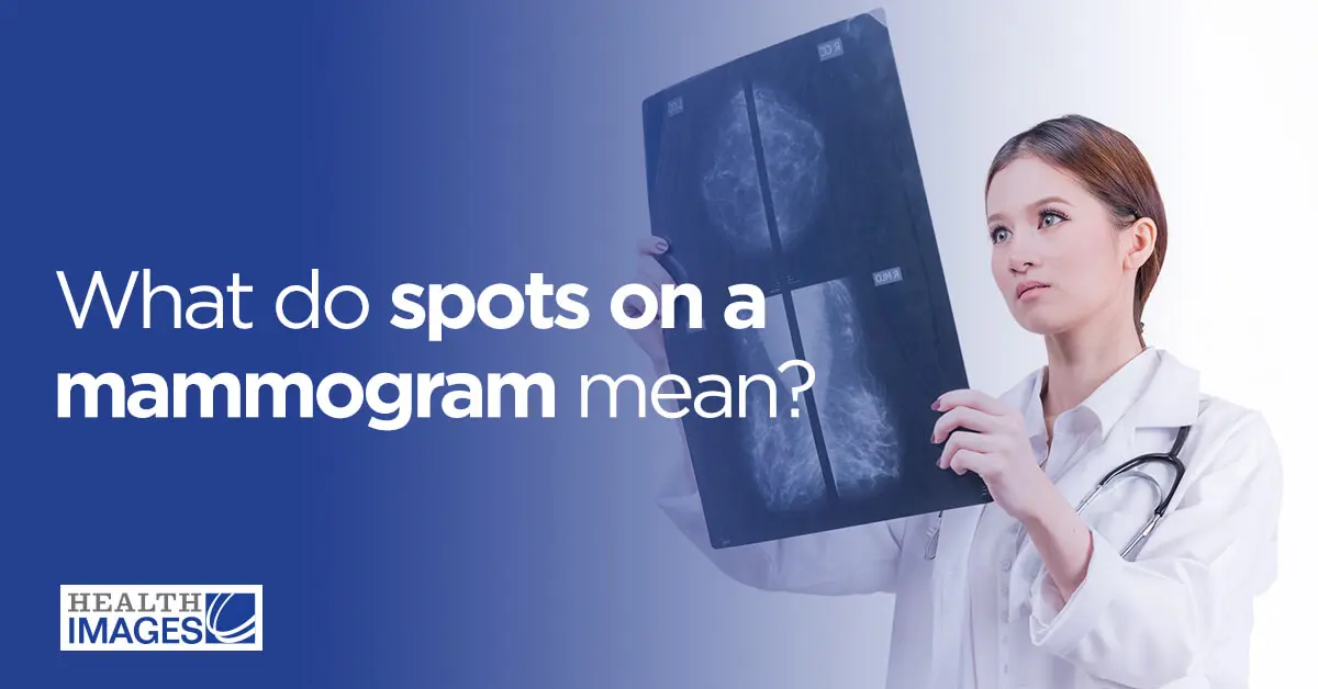 Mammogram Showing Cyst 5174