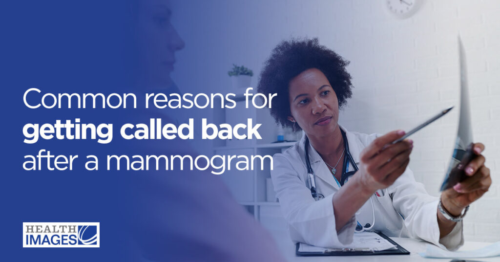 Common reasons for getting called back after a mammogram - Health Images