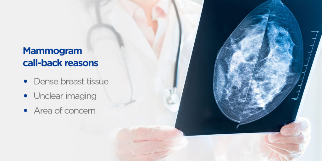 Common reasons for getting called back after a mammogram - Health Images