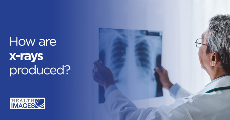 How are X-rays Produced? - Health Images