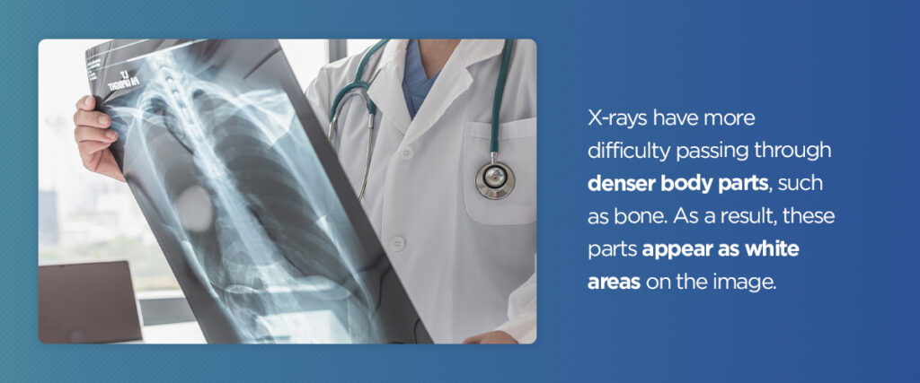 How are X-rays Produced? - Health Images