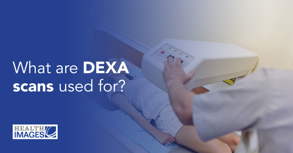 What are DEXA scans used for? - Health Images