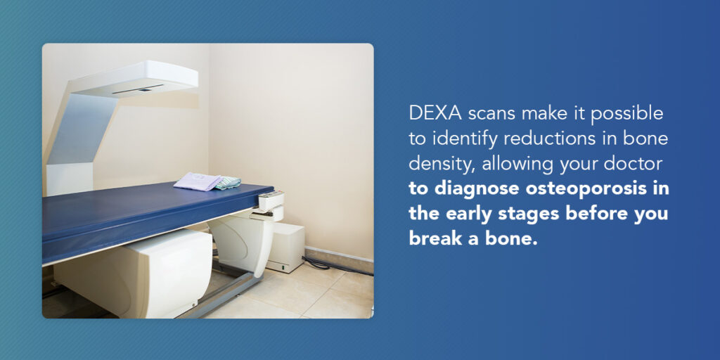 What are DEXA scans used for? - Health Images